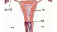 搞懂“子宫输卵管造影”,有这篇就够了