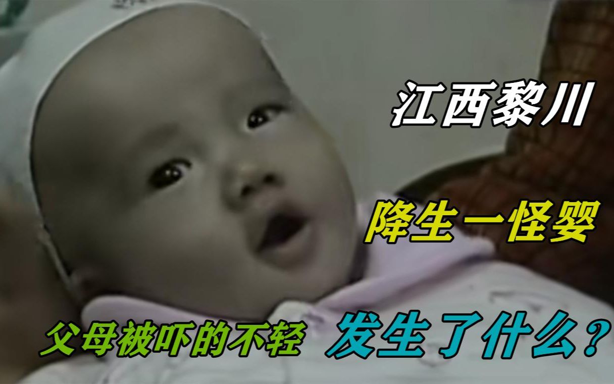 刚出生的婴儿,背后竟有一个小尾巴,得知真相令人辛酸