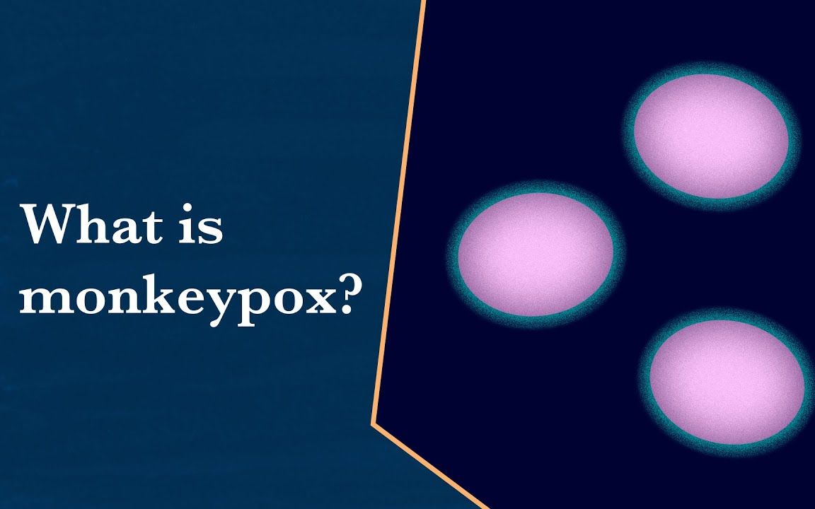 什么是猴痘? | 双语字幕 | 医学动画 | 医学英语
