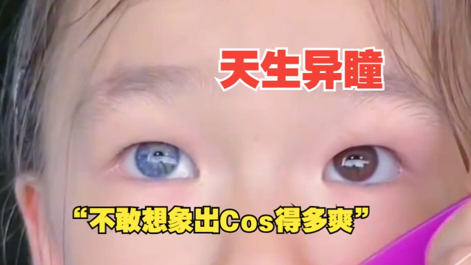7岁女孩天生异瞳,在学校受到同学喜爱,妈妈:悬着的心放下了!