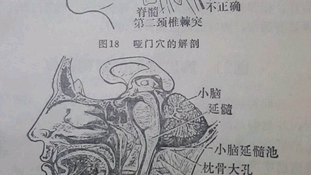 图18哑门穴的解剖图19头颈正中矢状切面