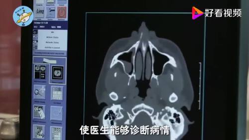 CT检查为何如此昂贵?拆解CT机后揭秘其内部构造