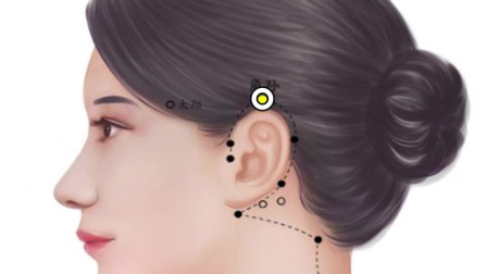 角孙穴:可缓解白内障、偏头痛、齿龈肿痛、口腔炎等症状!