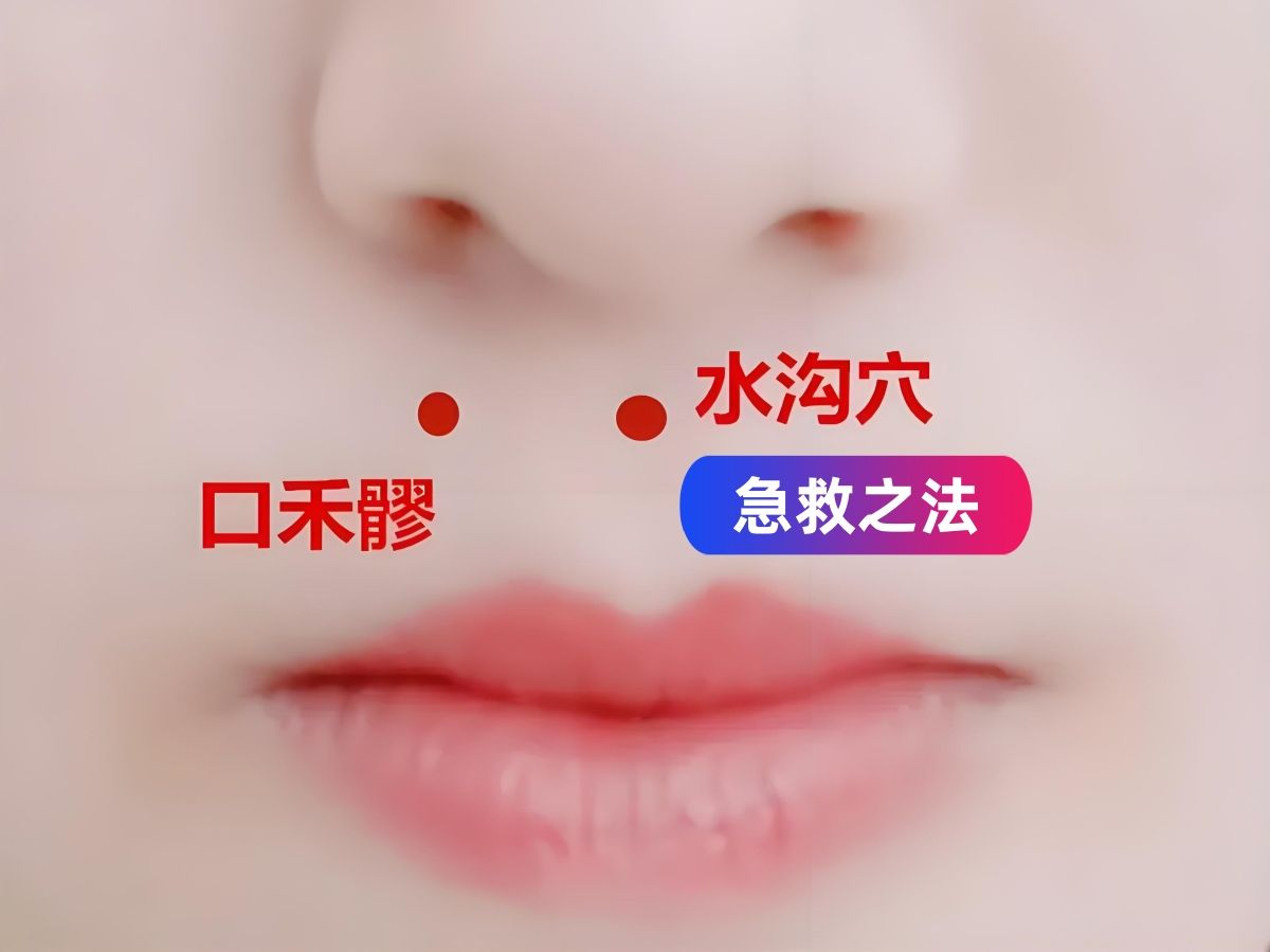 220、督脉 — 水沟穴 — 急救之法