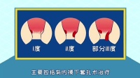 中国医大四院消化内镜科内痔硬化治疗宣传动画