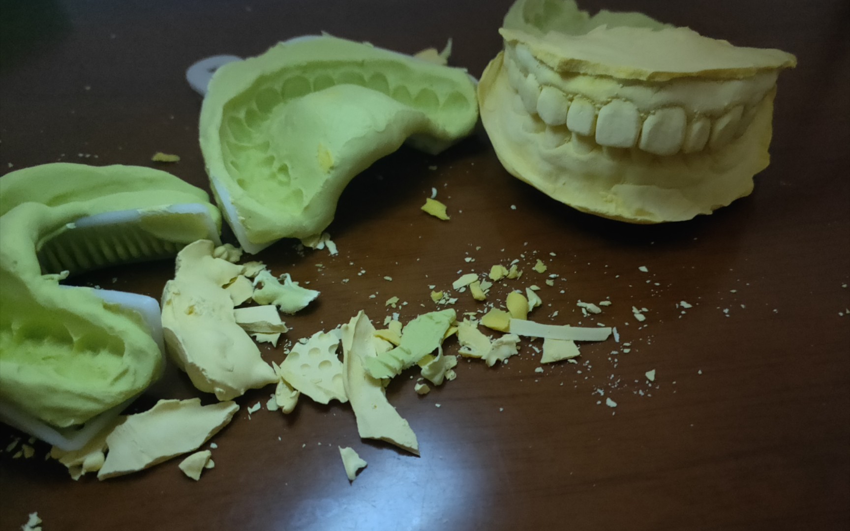 DIY牙模 挑战自己动手做牙模,新手也可以!一次成功。