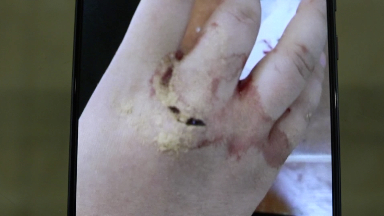 女子在住店被砸重伤索赔两年未果 法院上门送了一封处罚通知书