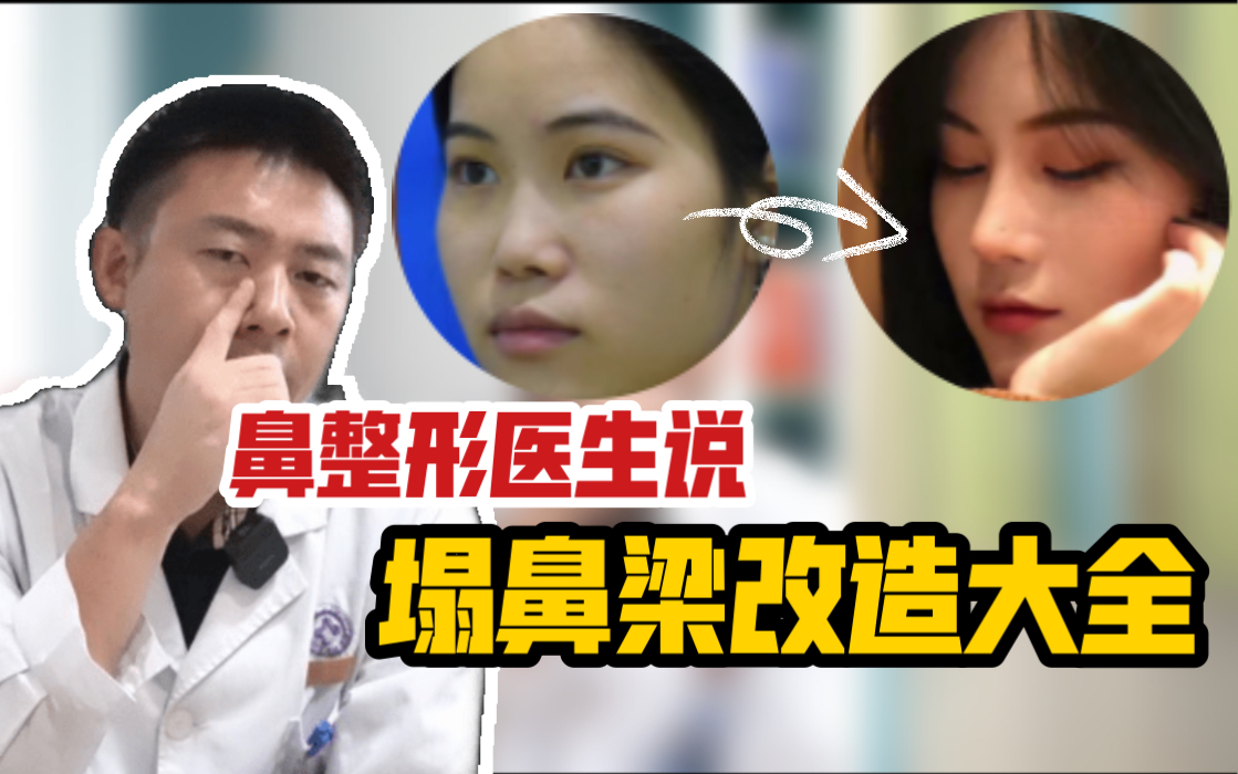 塌鼻梁如何变高变立体?2种方法即刻拥有好看鼻背,告别繁琐画鼻影