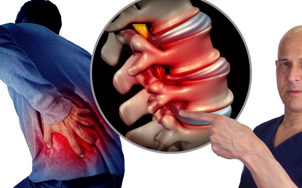 尝试这个简单的腰部拉伸练习,缓解腰部酸痛和背痛【Mandell博士】