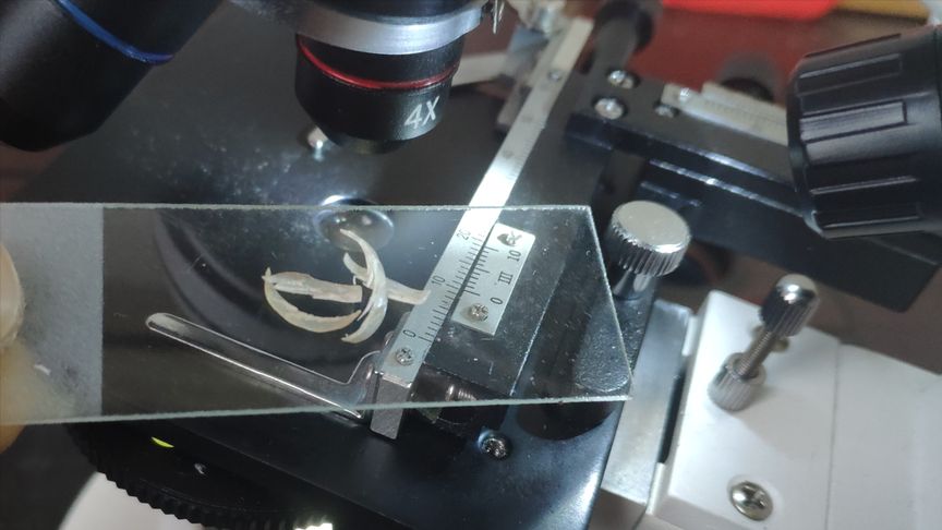 手指甲里面有多少细菌?显微镜下放大600倍,原来里面藏着40亿个