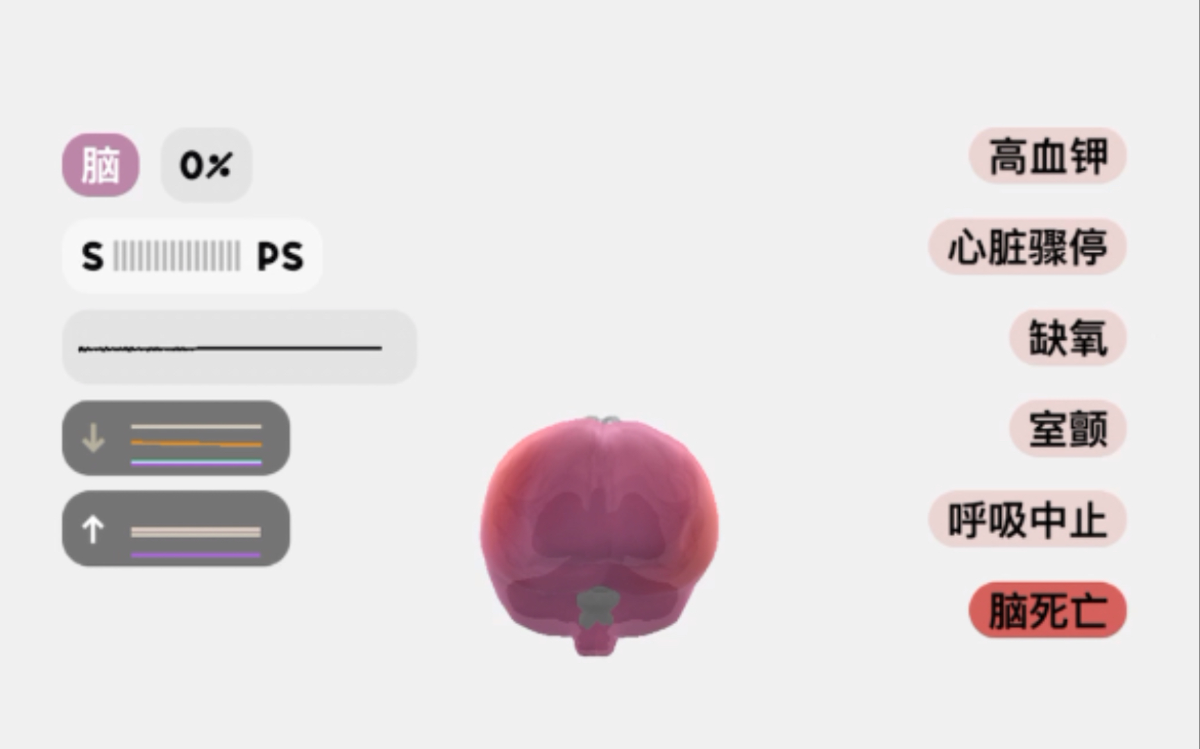 模拟——注射死刑