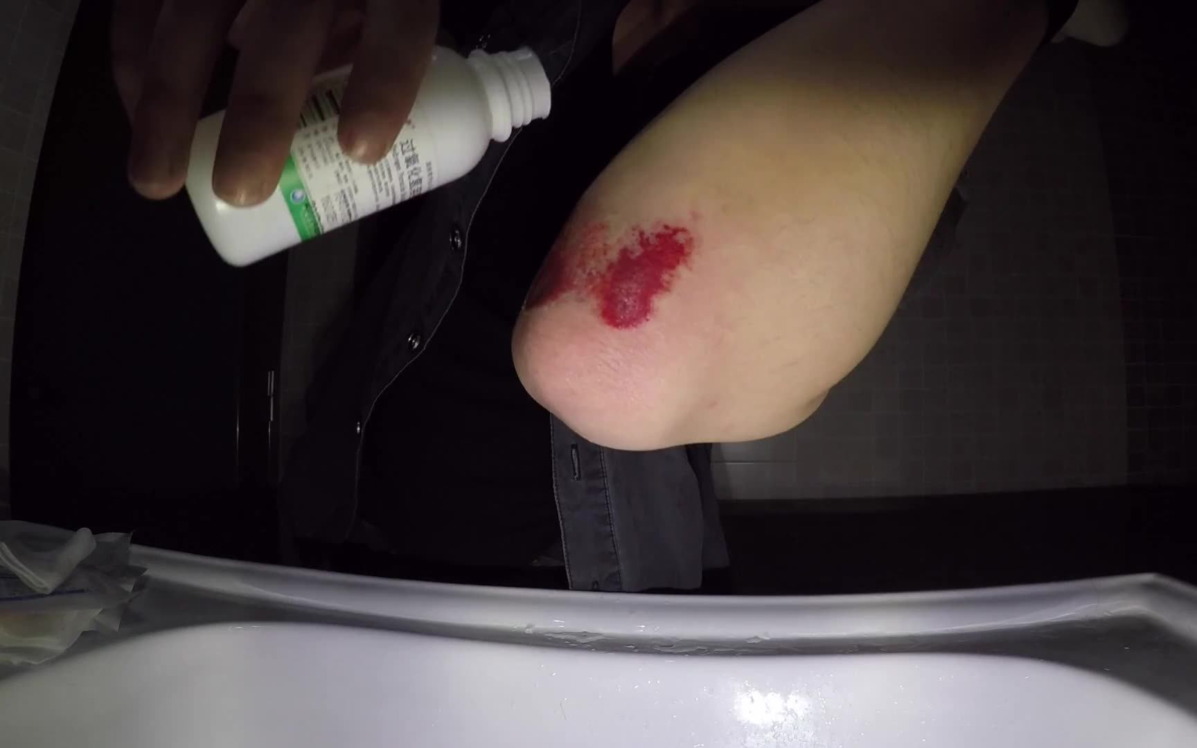 受伤后怎样自己处理伤口?我教你最不容易留疤的方法吧(大概)