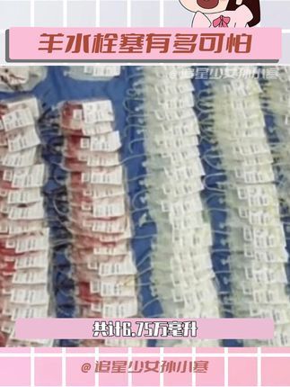 羊水栓塞有多可怕#科普 #羊水栓塞 #女性 #震惊 #怀孕 @DOU+小助手