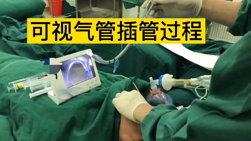 可视气管插管#医学科普 #涨知识
