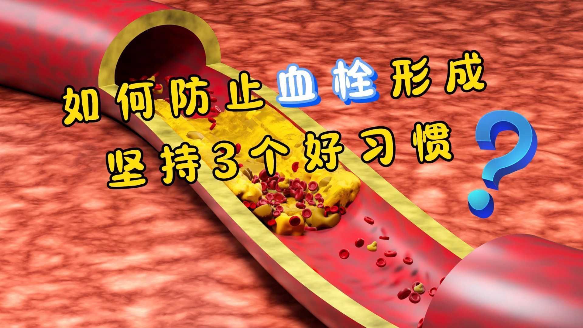 如何防止血栓形成?坚持3个好习惯,血管"畅通无阻"
