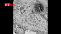 首张新型冠状病毒如何在细胞内复制图出炉!