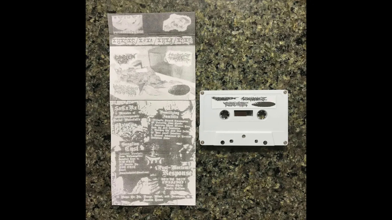 【Gore|Split】GANGLION CYST/POST-MORTEM RESPONSE(OG)/...
