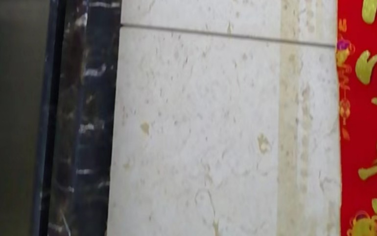 青岛上门到家拆线更换胃管输液换尿管随时