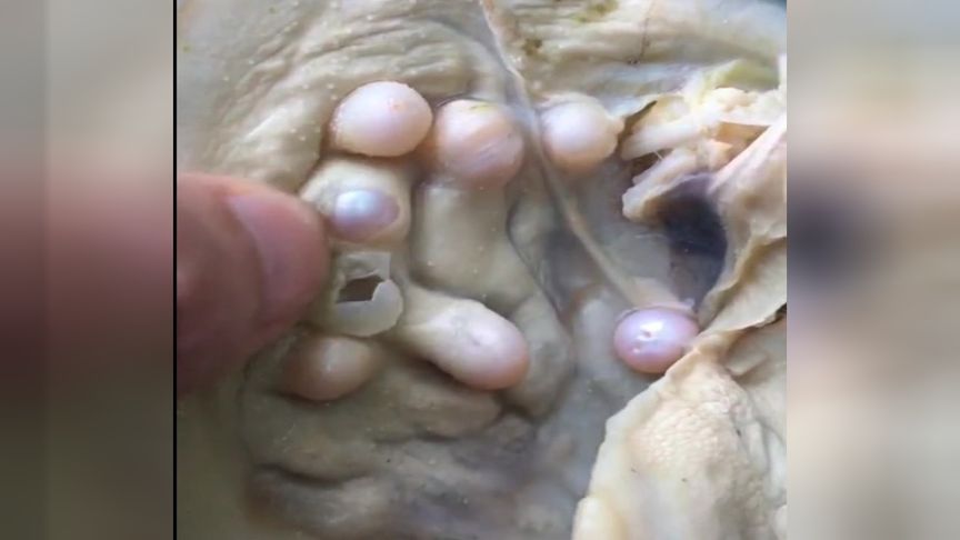 实拍蚌壳里取珍珠,看着很爽!