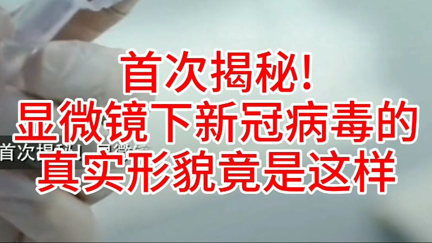 首次揭秘!显微镜下新冠病毒的真实形貌竟是这样
