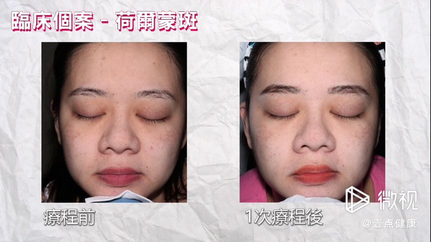 超详细皮秒功能测试!这些功能你了解么?