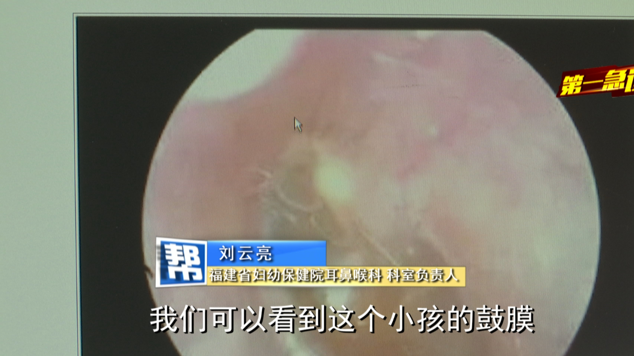 鼻腔冲洗器别用错,福州一名孩子鼻腔冲洗不当,听力骤降!