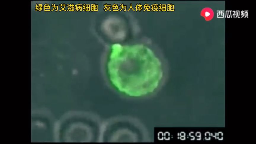 显微镜下的艾滋病毒是如何入侵身体,免疫细胞和艾滋病毒如何厮杀