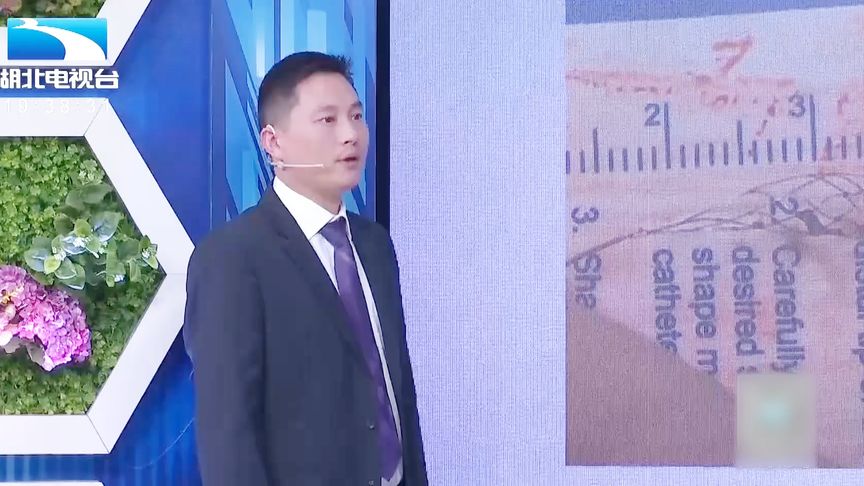 什么是动脉取栓?专家用动画来演示全过程!取出的血栓原来长这样
