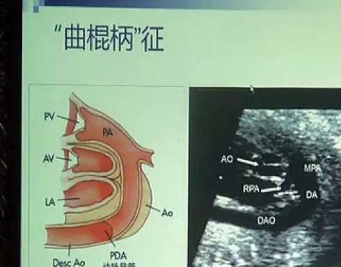 胎儿循环系统正常结构的超声检测及临床意义---董凤群2011