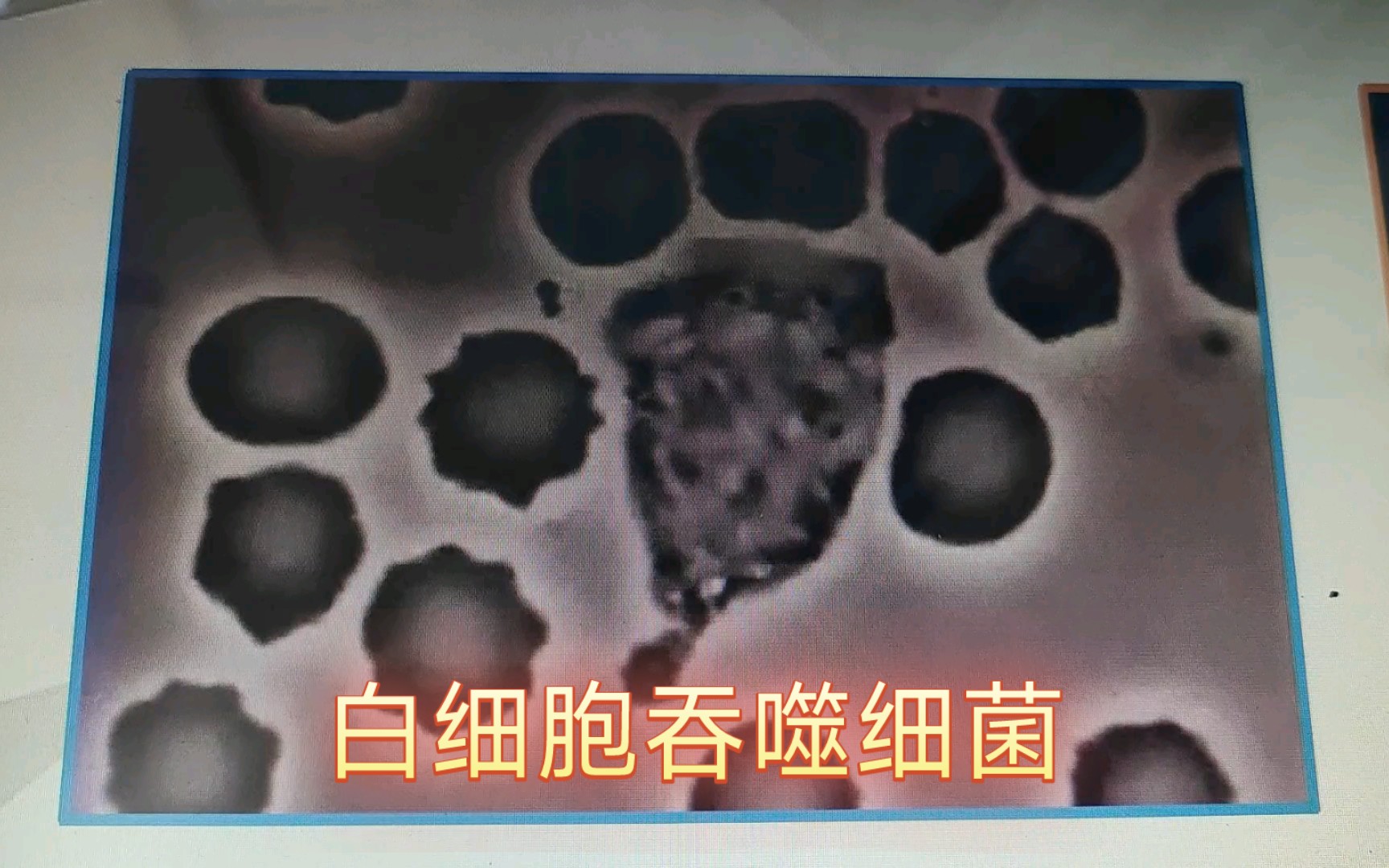 真实的光学显微镜下白细胞吞噬细菌的视频!