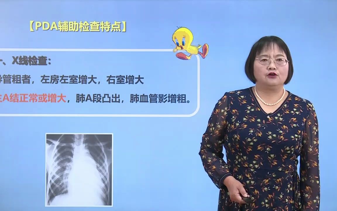 [11.2.8]--动脉导管未闭的辅助检查