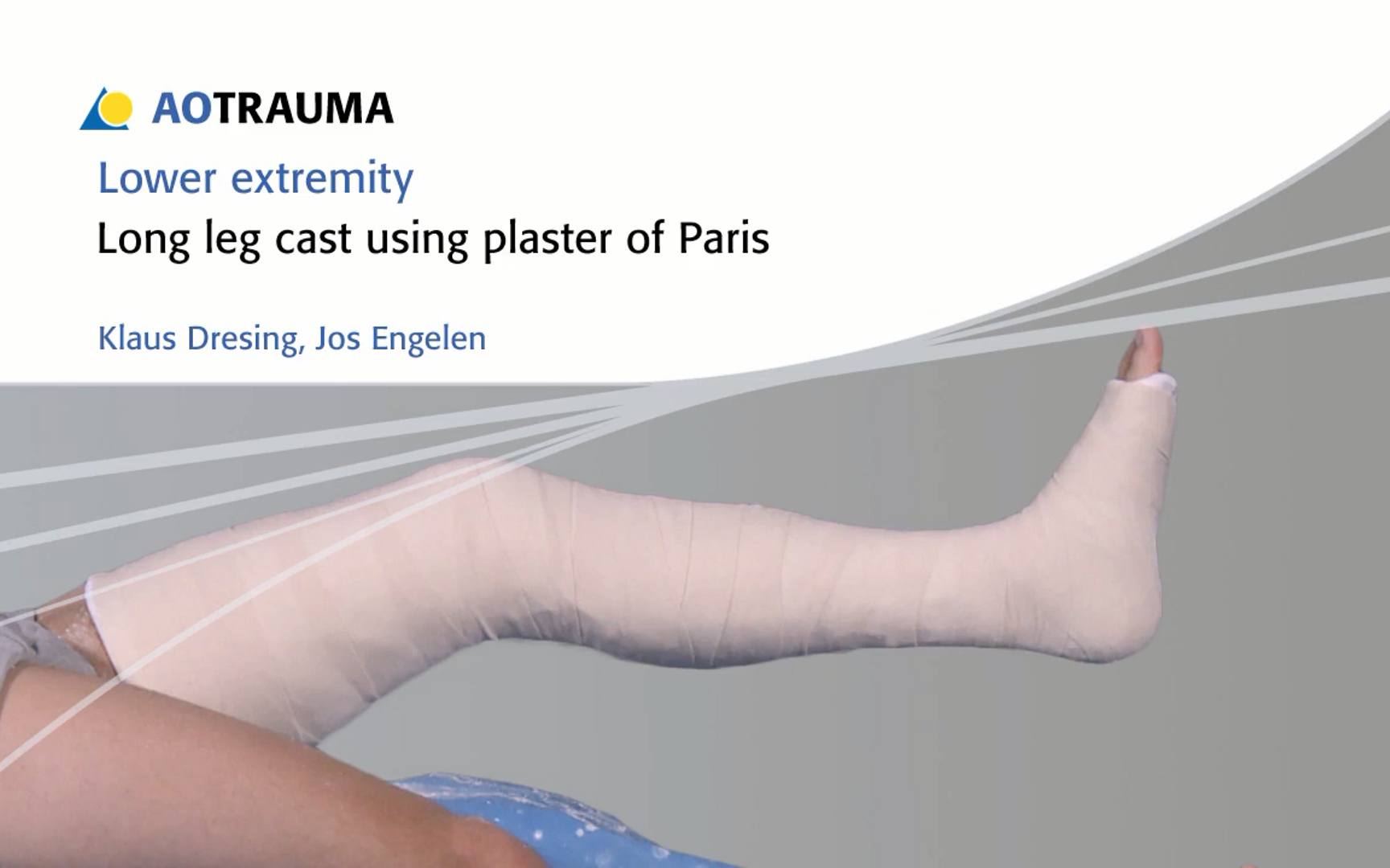 高分子绑带使用方法