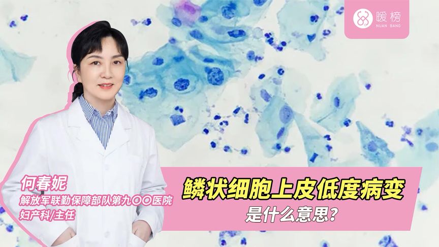 鳞状细胞上皮低度病变是什么意思?
