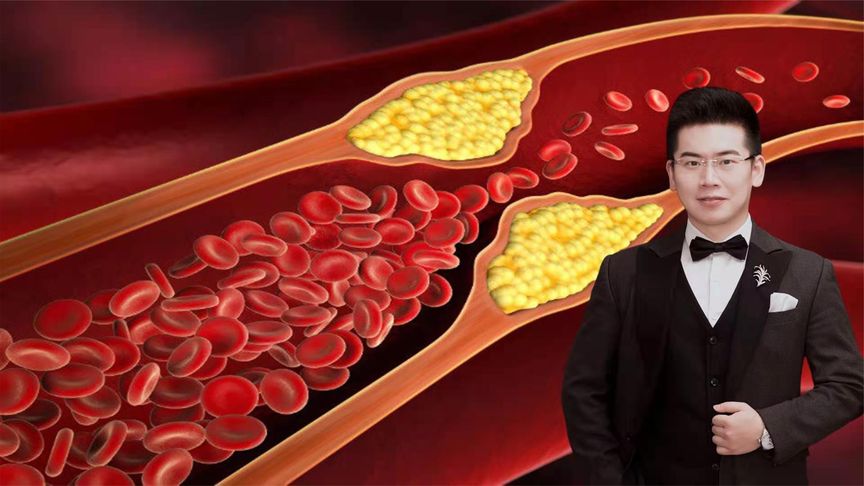 血管狭窄可以被药物完全疏通吗?