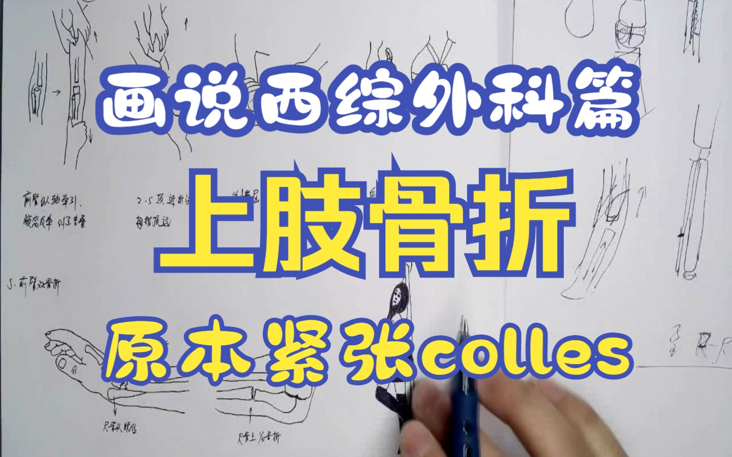 【画说西综外科篇】4、上肢骨折:前臂双骨折、桡骨远端骨折