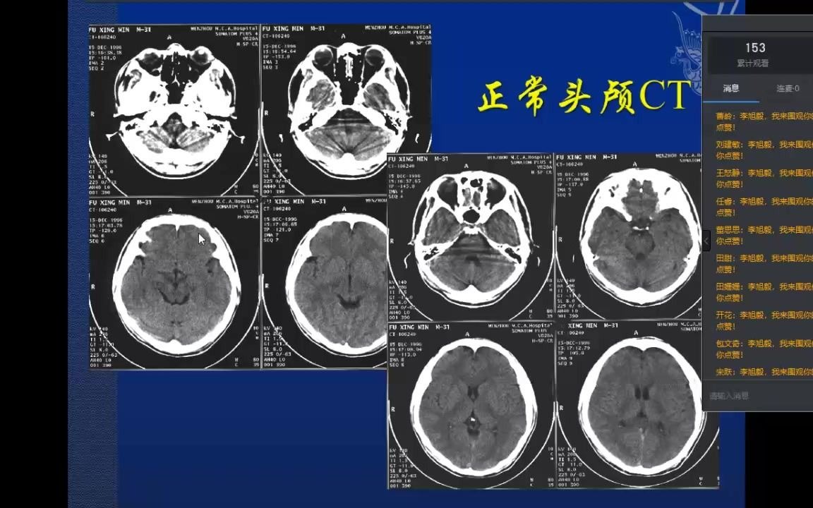 温州医科大学附属第二医院放射科陈伟——住院医师规范化培训课程《...
