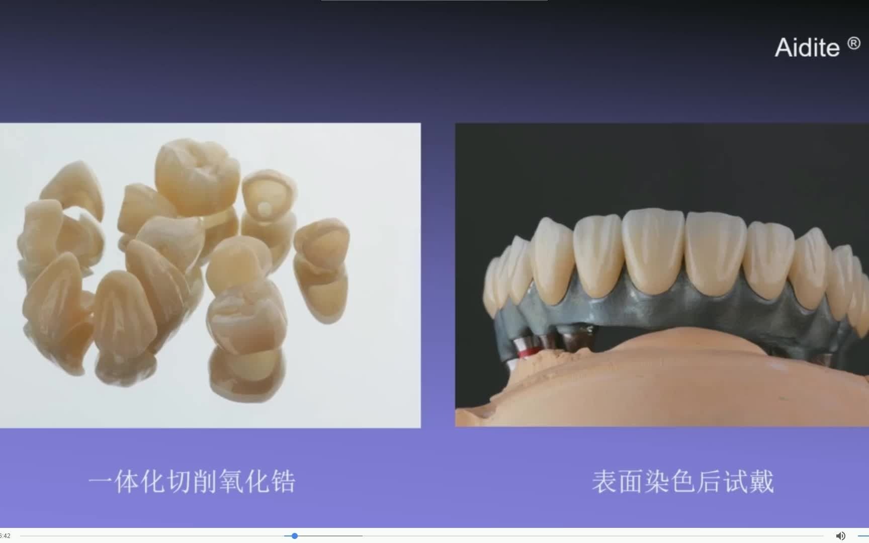 EXOCAD前牙全形态的设计