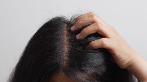 湿气重的人必看!这些症状你中招了吗?赶紧自查一下!