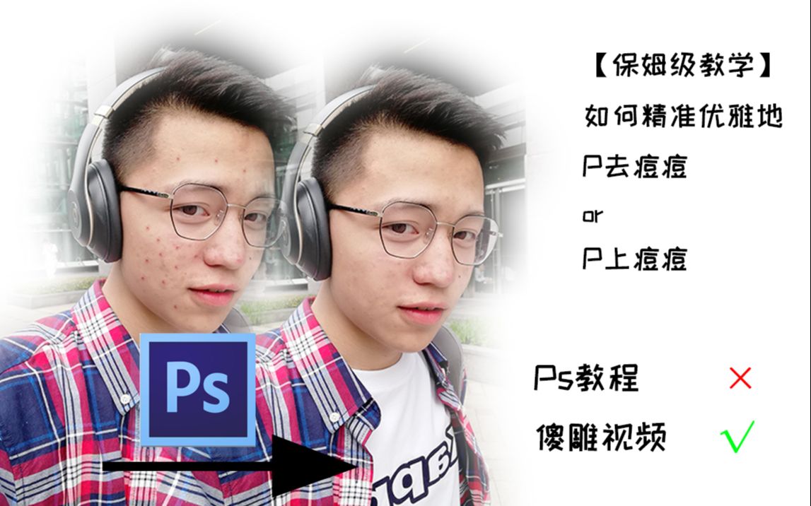 ...向保姆级Ps教学】看油腻高中生如何精准而优雅地P去脸上的痘痘(...