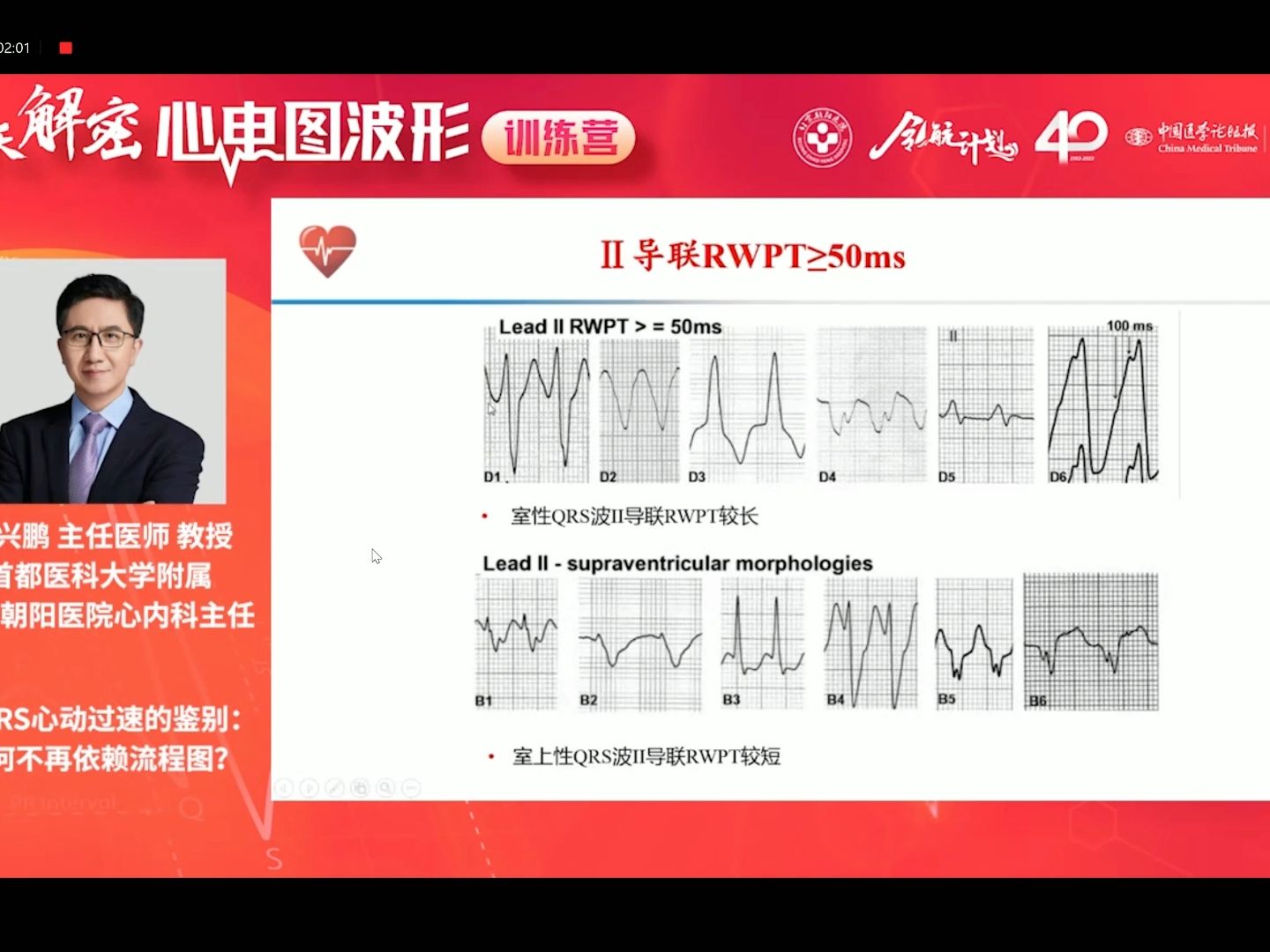 Day13 宽QRS心动过速的鉴别:如何不再依赖流程图?