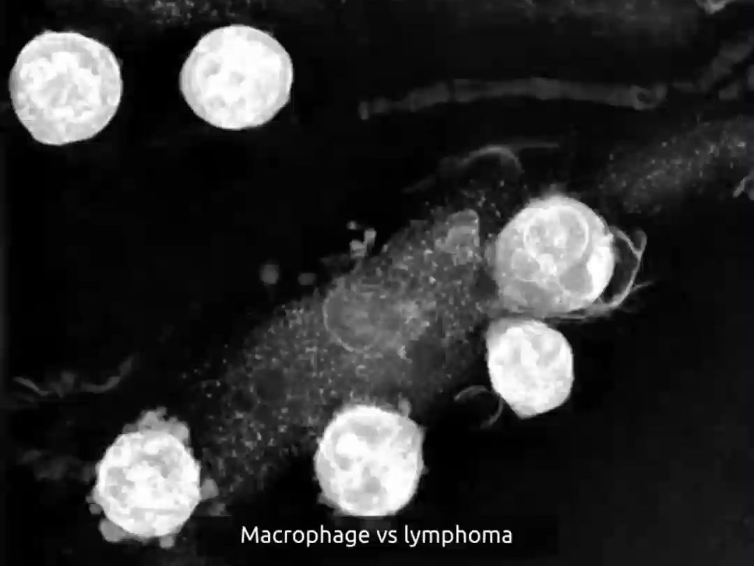 巨噬细胞吞噬淋巴瘤细胞过程演示