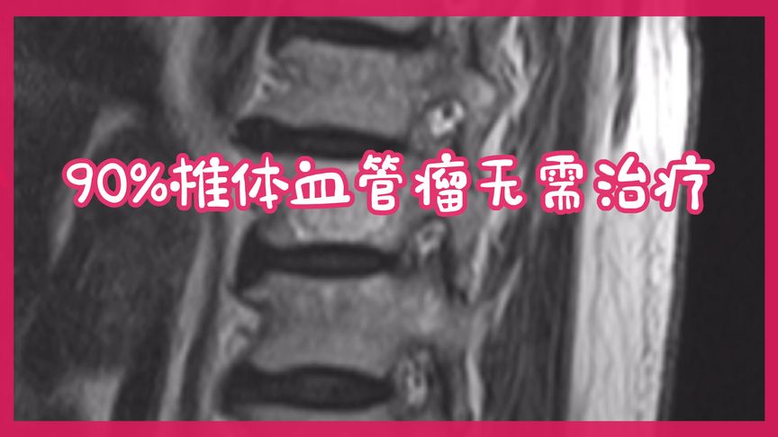 椎体血管瘤,你因这张磁共振报告而担心过吗?