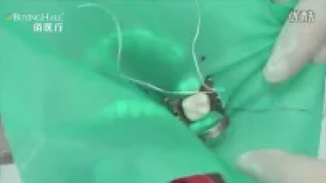 佰医行牙科橡皮障操作视频1