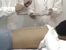 艾灸视频 艾灸疗法 艾灸的操作手法 艾柱灸直接灸隔物灸隔姜灸隔附子灸