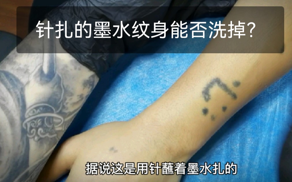 洛阳洗纹身:墨水纹身能洗掉吗?曾经风靡一时的针扎墨水小纹身,看完你...