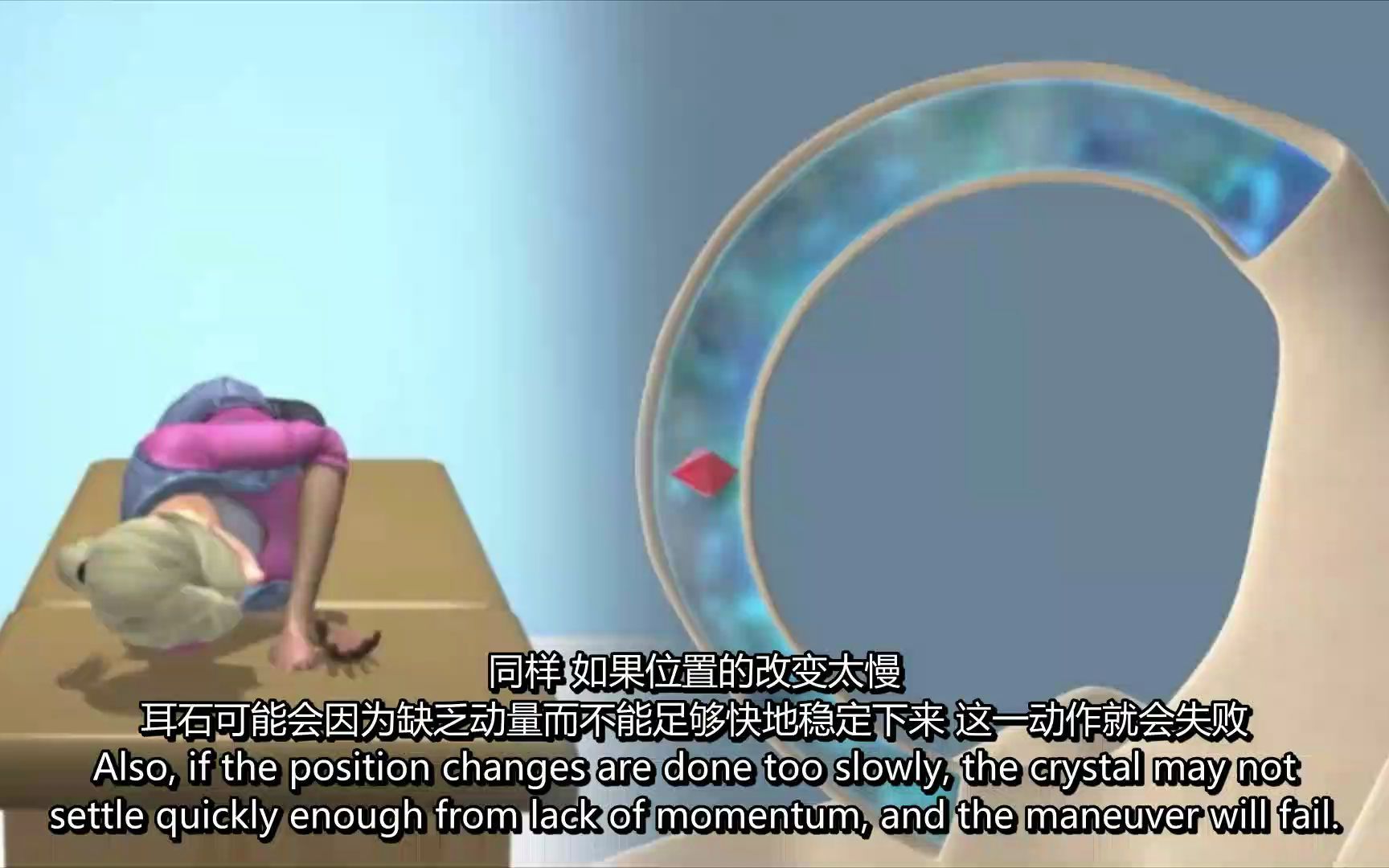 Lempert(BBQ)手法-治疗良性阵发性位置性眩晕(外侧/水平规管)