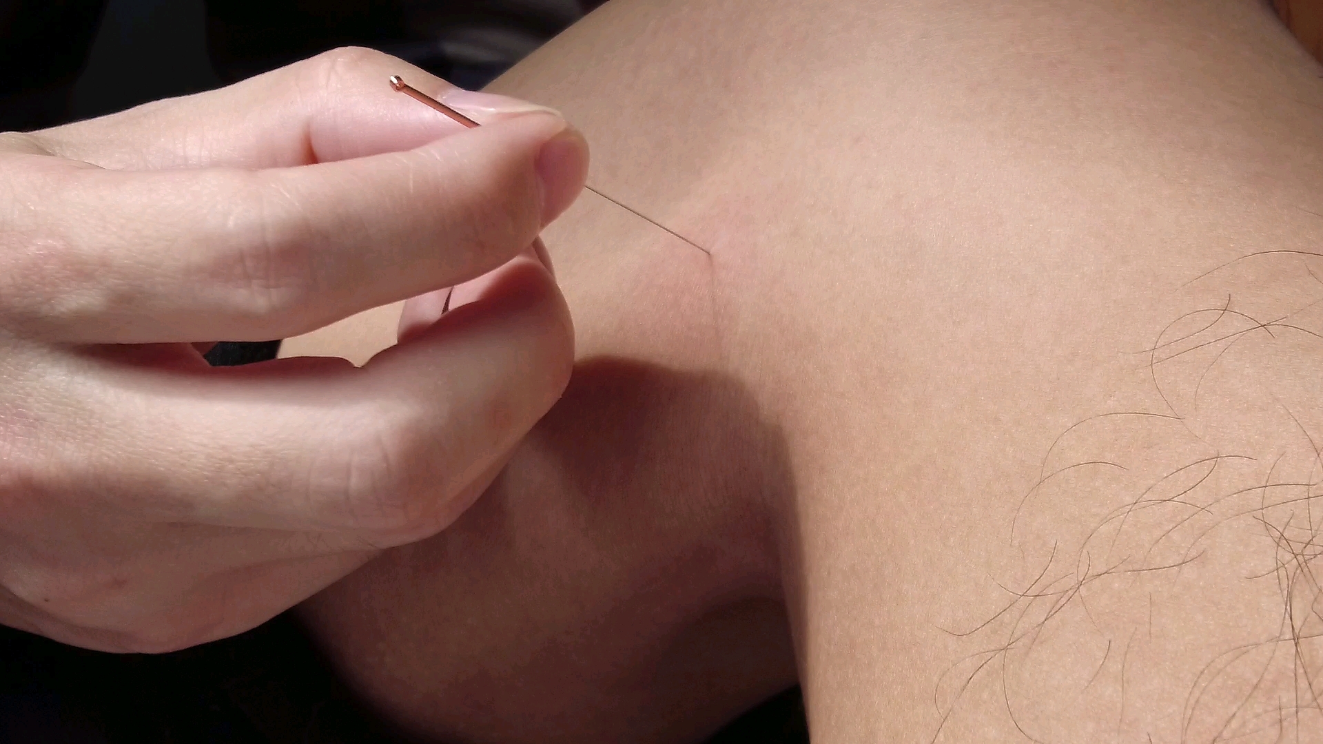 扎针练习曲泉穴