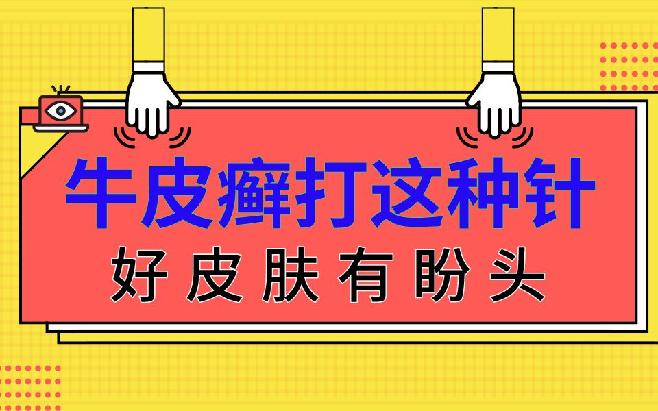 牛皮癣打这种针,好皮肤有盼头