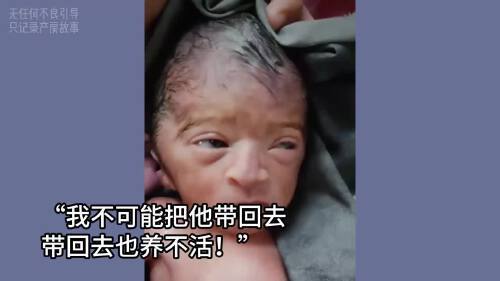 "宝宝心脏畸形诊断:父母的艰难选择与隐瞒真相的背后"