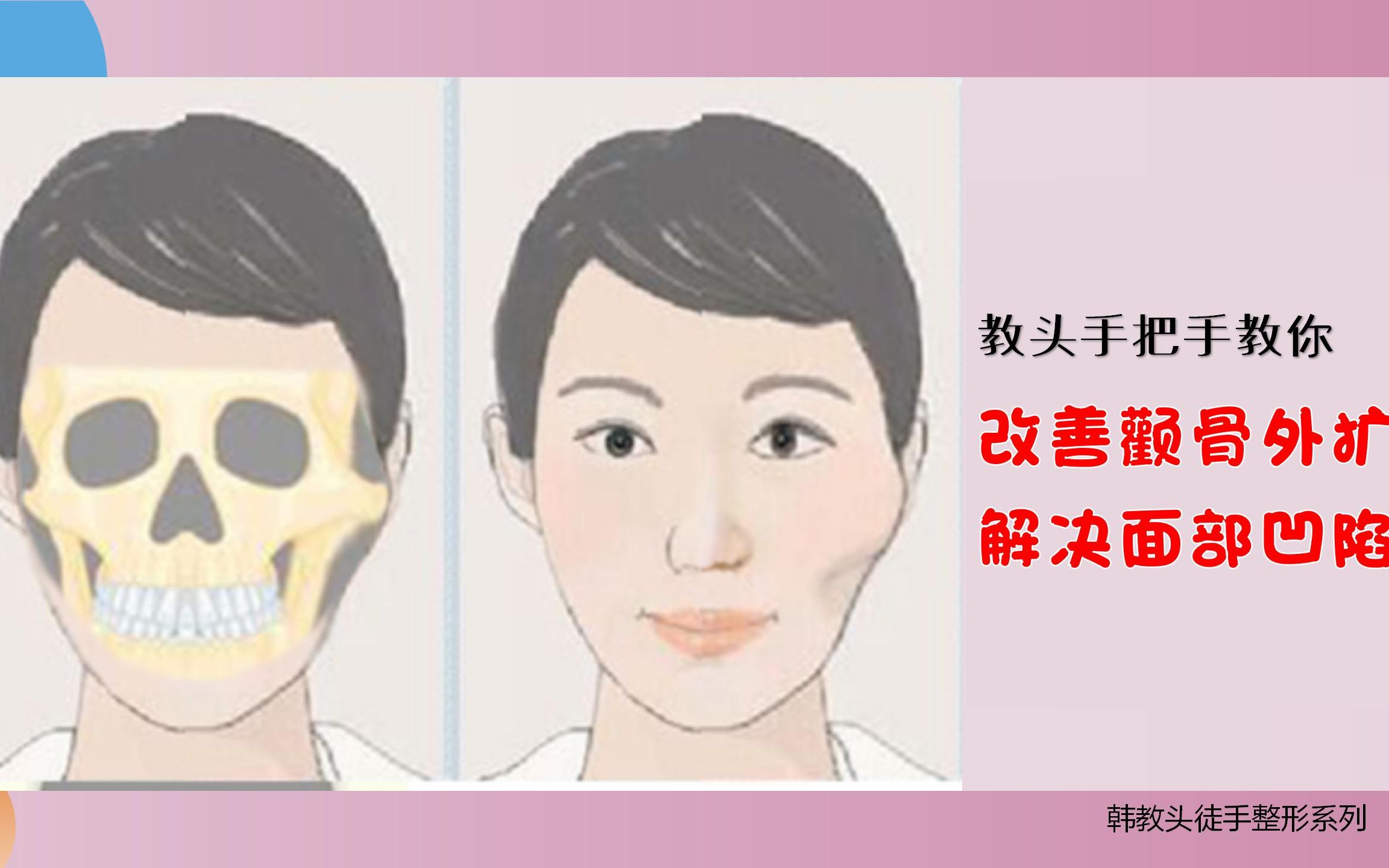 教头手把手教你矫正颧骨外扩,告别面部凹陷